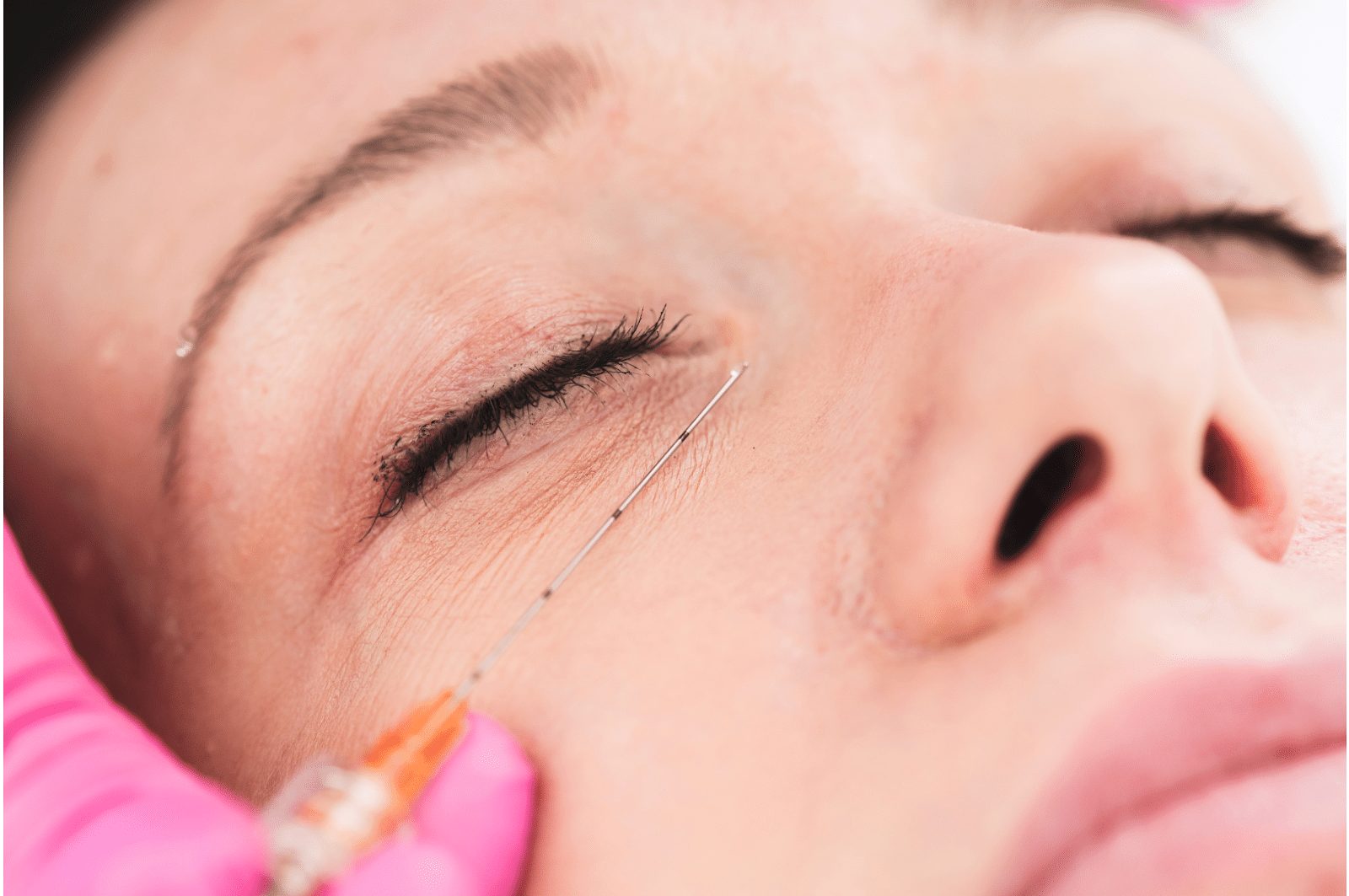 Types Of Under Eye Filler Belotero Med Supply Solutions