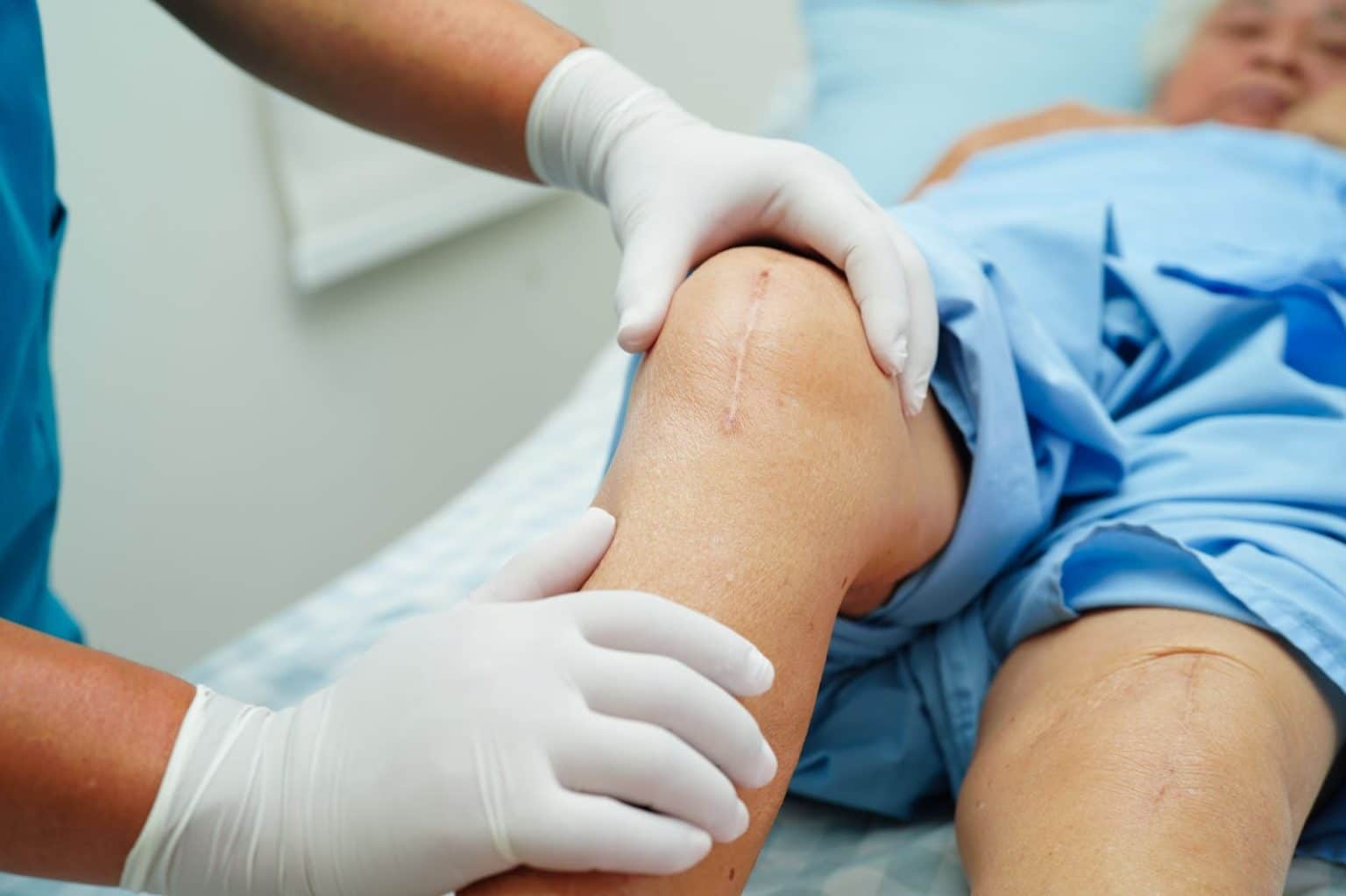 Orthovisc Treatment: A Complete Guide to Knee Injections