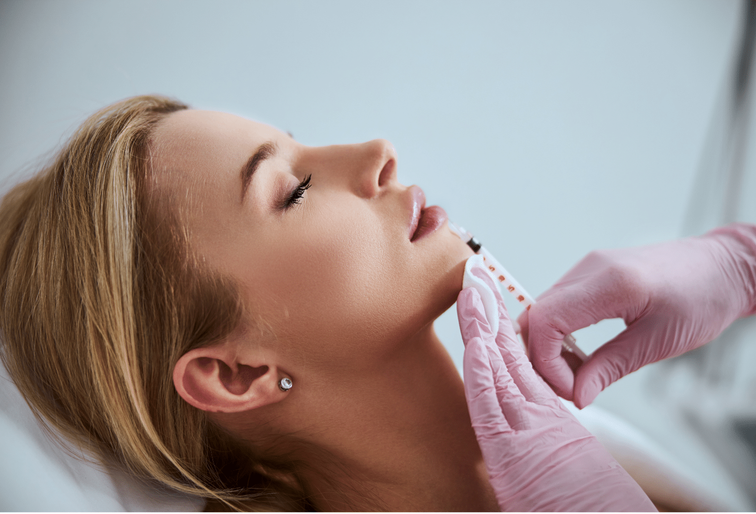 Revanesse Versa Lip Filler: All About the Product