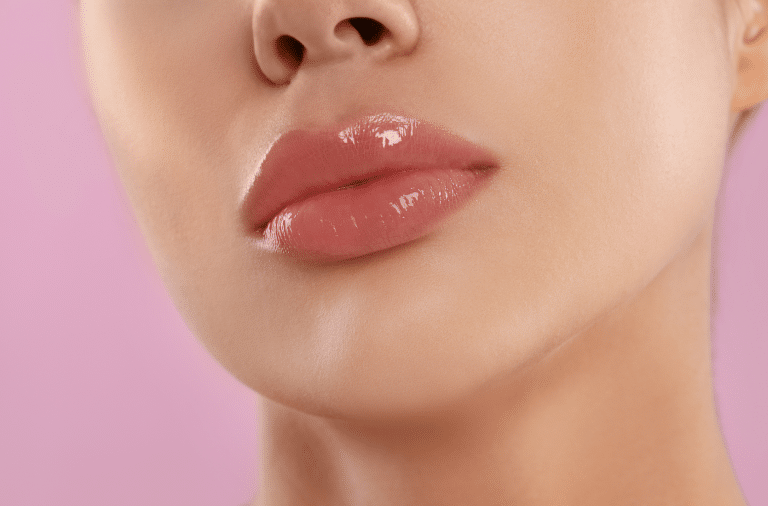 Revanesse Versa Lip Filler: All About the Product